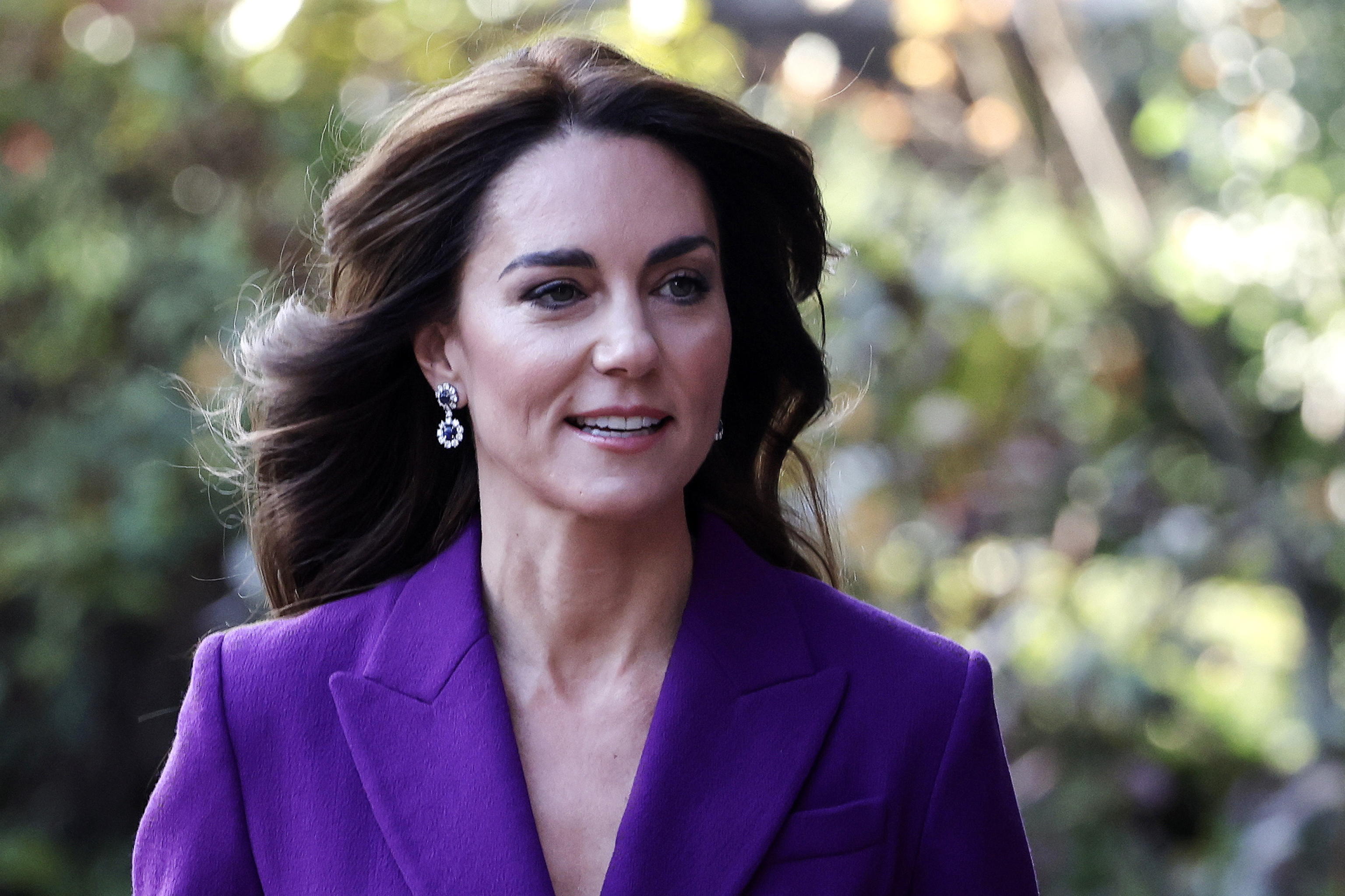 Kate Middleton, tumore in remissione a un anno dal ricovero per la malattia | Sky TG24