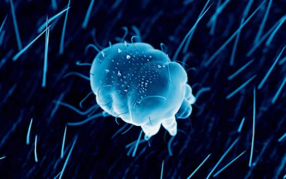 Nel Regno Unito è tornata la scabbia, contagi raddoppiati e ambulatori ...
