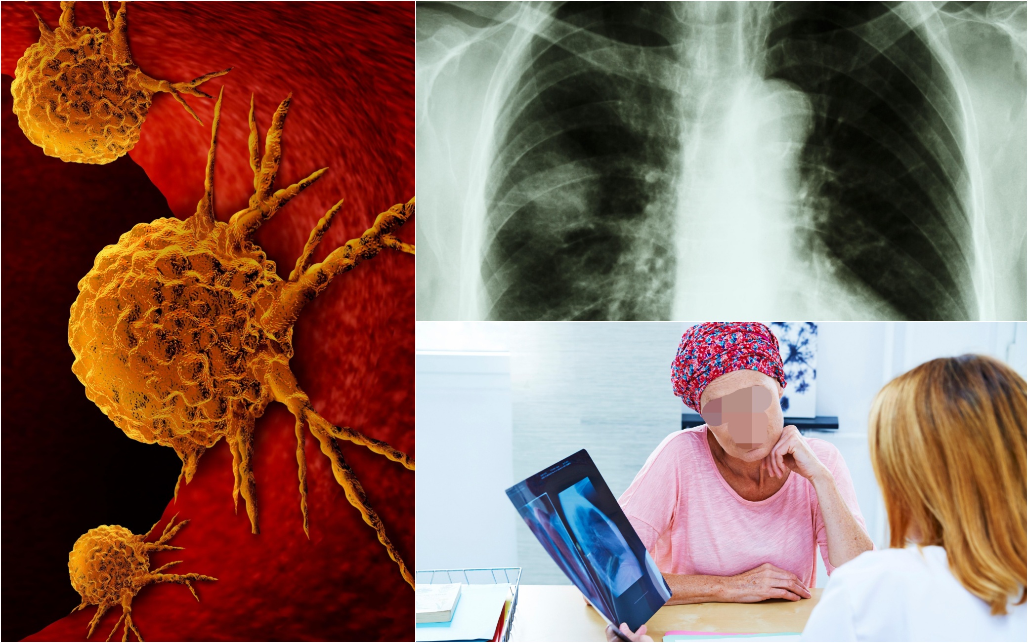 Franco Di Mare: 'Ho un tumore incurabile, da inviato di guerra ho ...