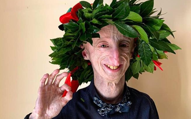 Sammy Basso, la mamma: 'Averlo come figlio è stato un dono' | Sky TG24