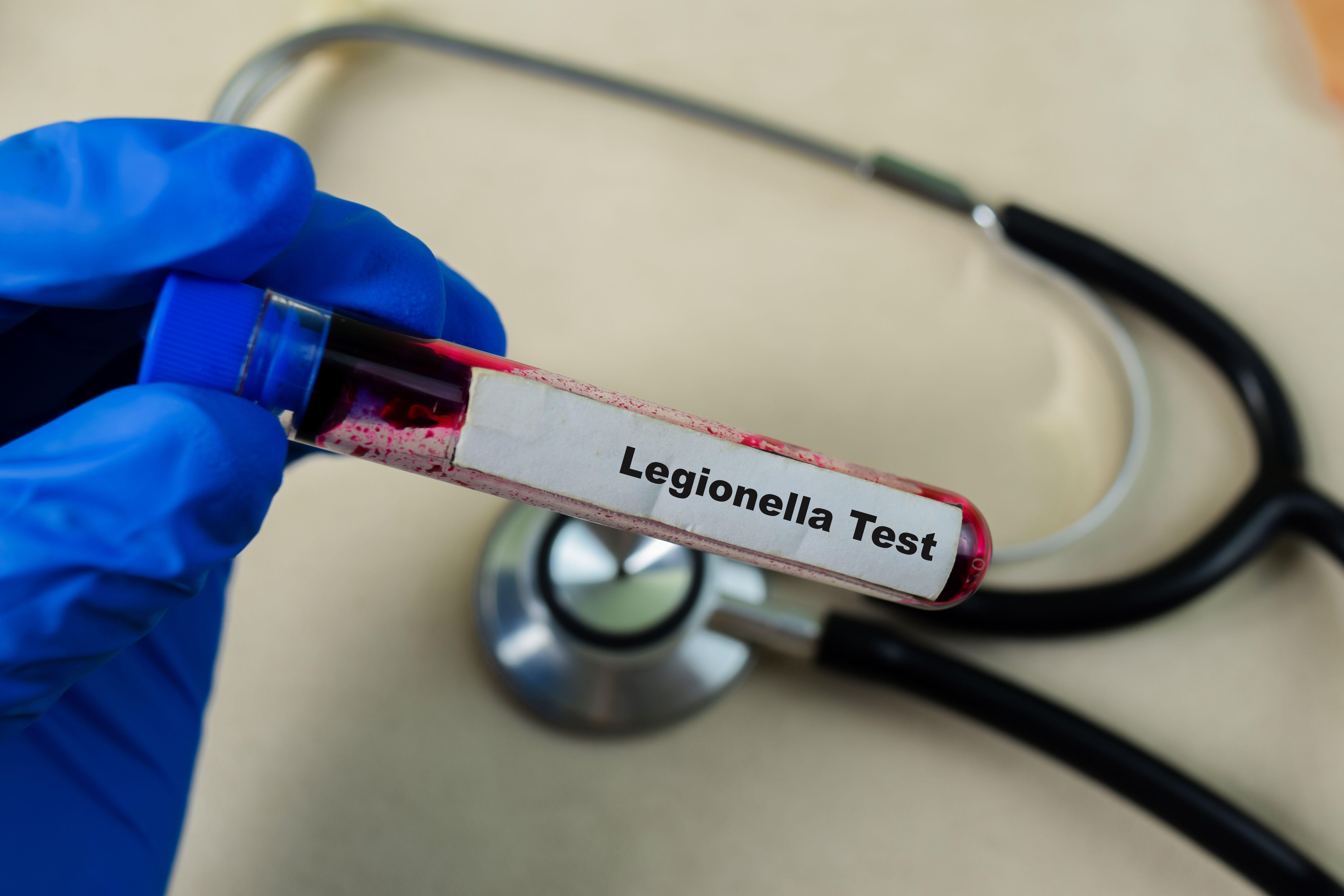 Legionella, sintomi e come si prende la malattia: gli ambienti a ...