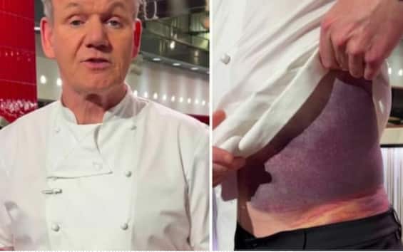 Gordon Ramsay mostra i segni dell'incidente in bici. VIDEO | Sky TG24