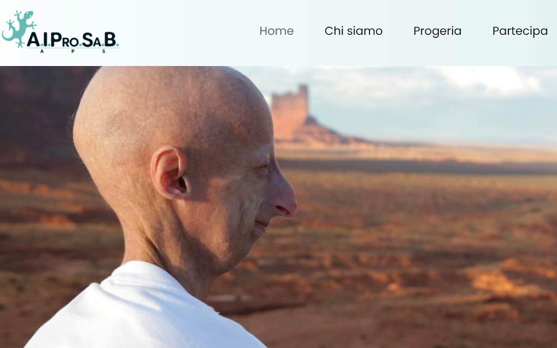 E' morto Sammy Basso, il 28enne malato di progeria: chi era | Sky TG24