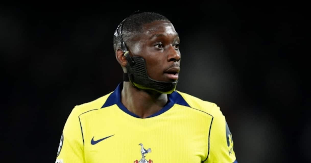 Kolo Muani (Tottenham) indossa una mascherina dopo un colpo alla ...