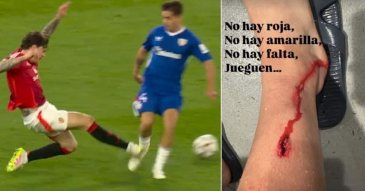 Un buco nella gamba di Prados: la rabbia dell'Athletic per la ...