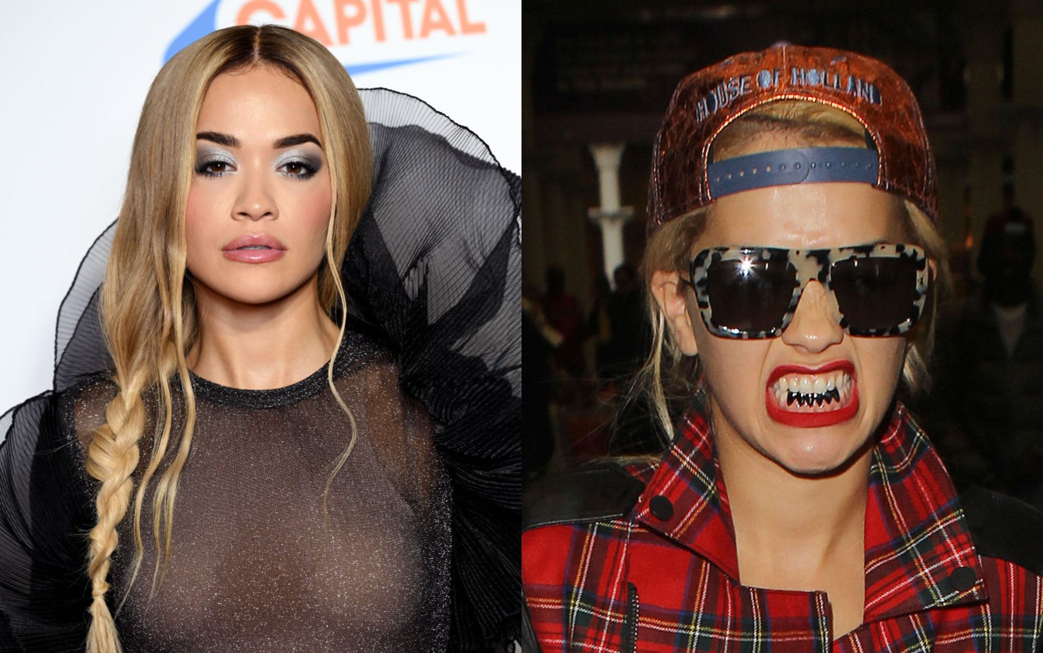 Non solo Kanye West, i denti più folli delle star: da Madonna a Justin Bieber