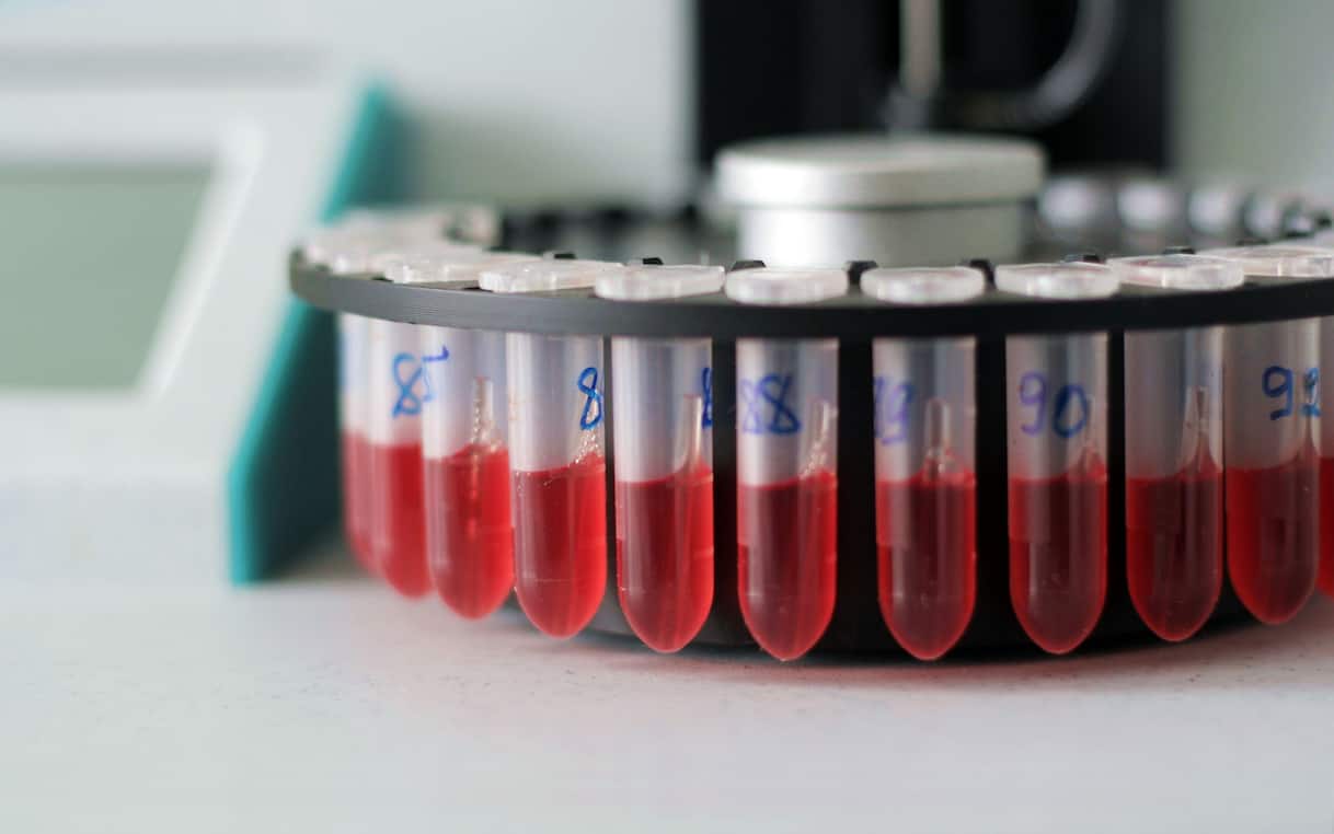 Italy hosts World AIDS Day events with free testing and prevention ...