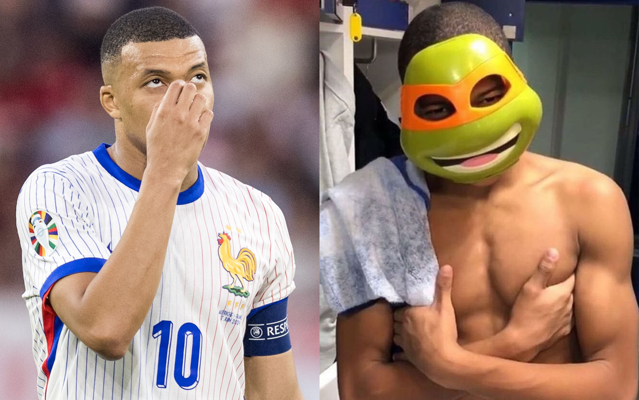 Mbappe, infortunio al naso: news dalla Francia e tempi di recupero ...