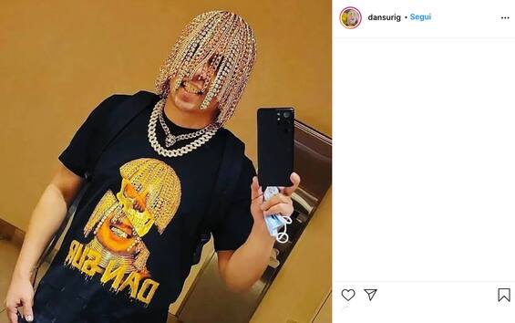 Dan Sur, il rapper si è fatto impiantare catene d'oro al posto dei capelli