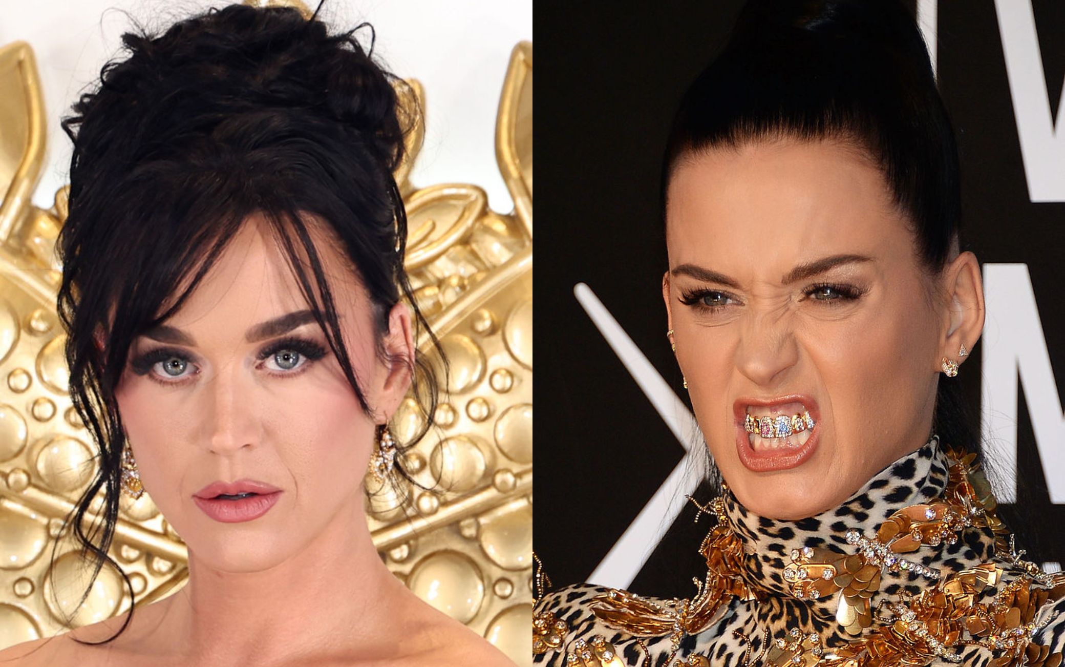 Non solo Kanye West, i denti più folli delle star: da Madonna a Justin ...