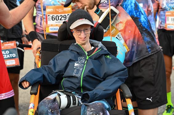 Progeria, cos'è la malattia di cui soffriva Sammy Basso | Sky TG24