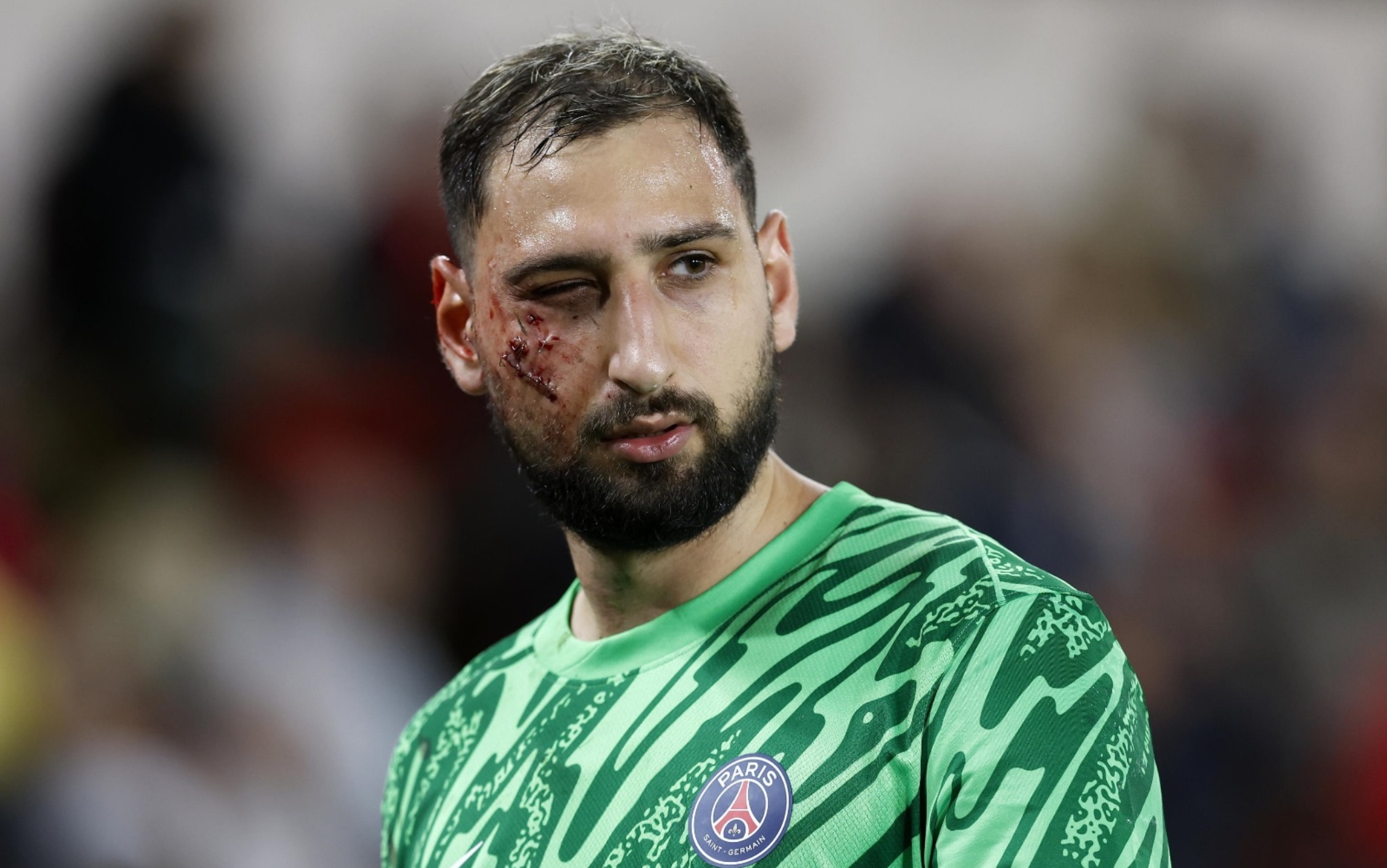 Infortunio Donnarumma in Monaco-Psg dopo un tremendo scontro con Singo ...