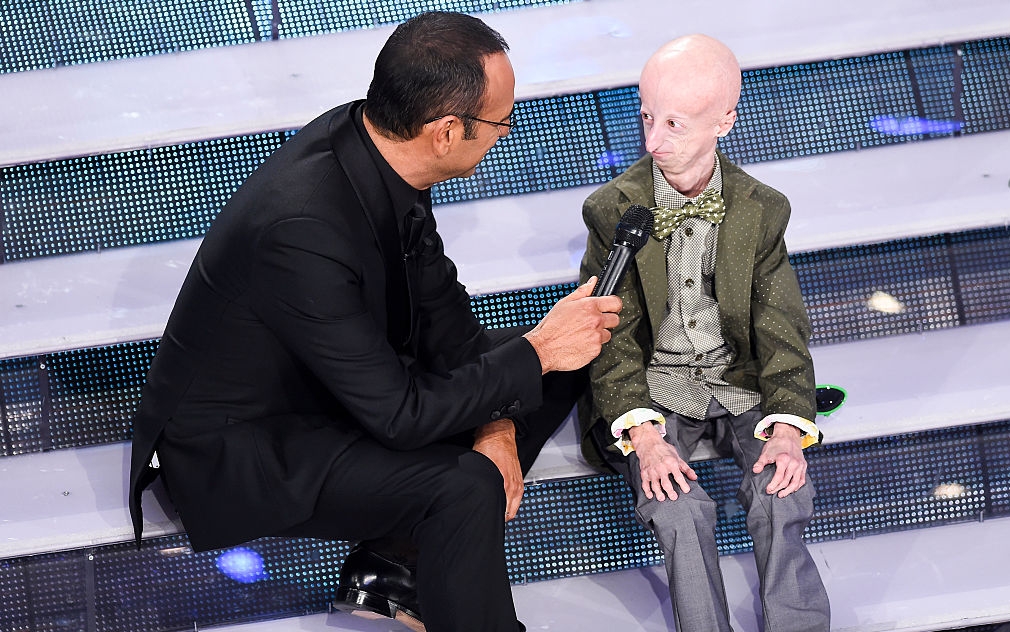 E' morto Sammy Basso, il 28enne malato di progeria: chi era | Sky TG24