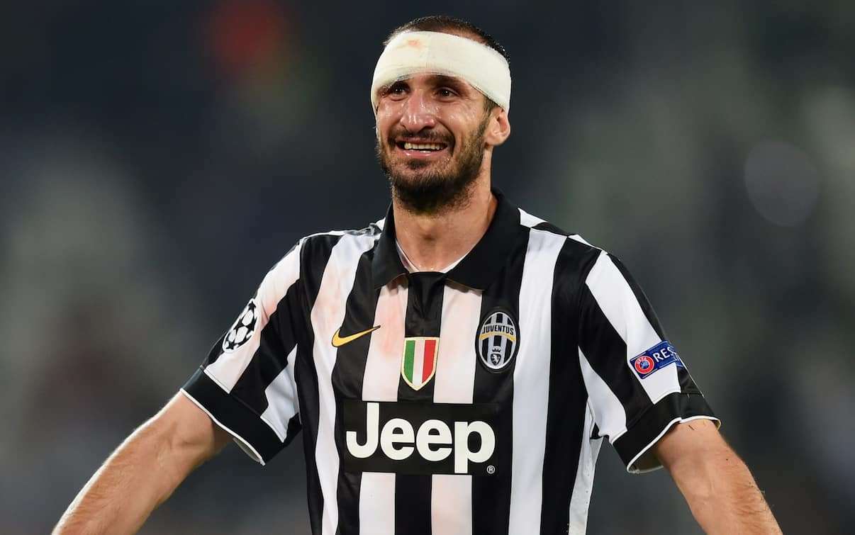 Maschere, caschi e bende: quando l'accessorio diventa icona | Sky Sport