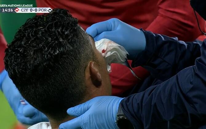 Nations League, Cristiano Ronaldo subisce un duro colpo al naso ma ...