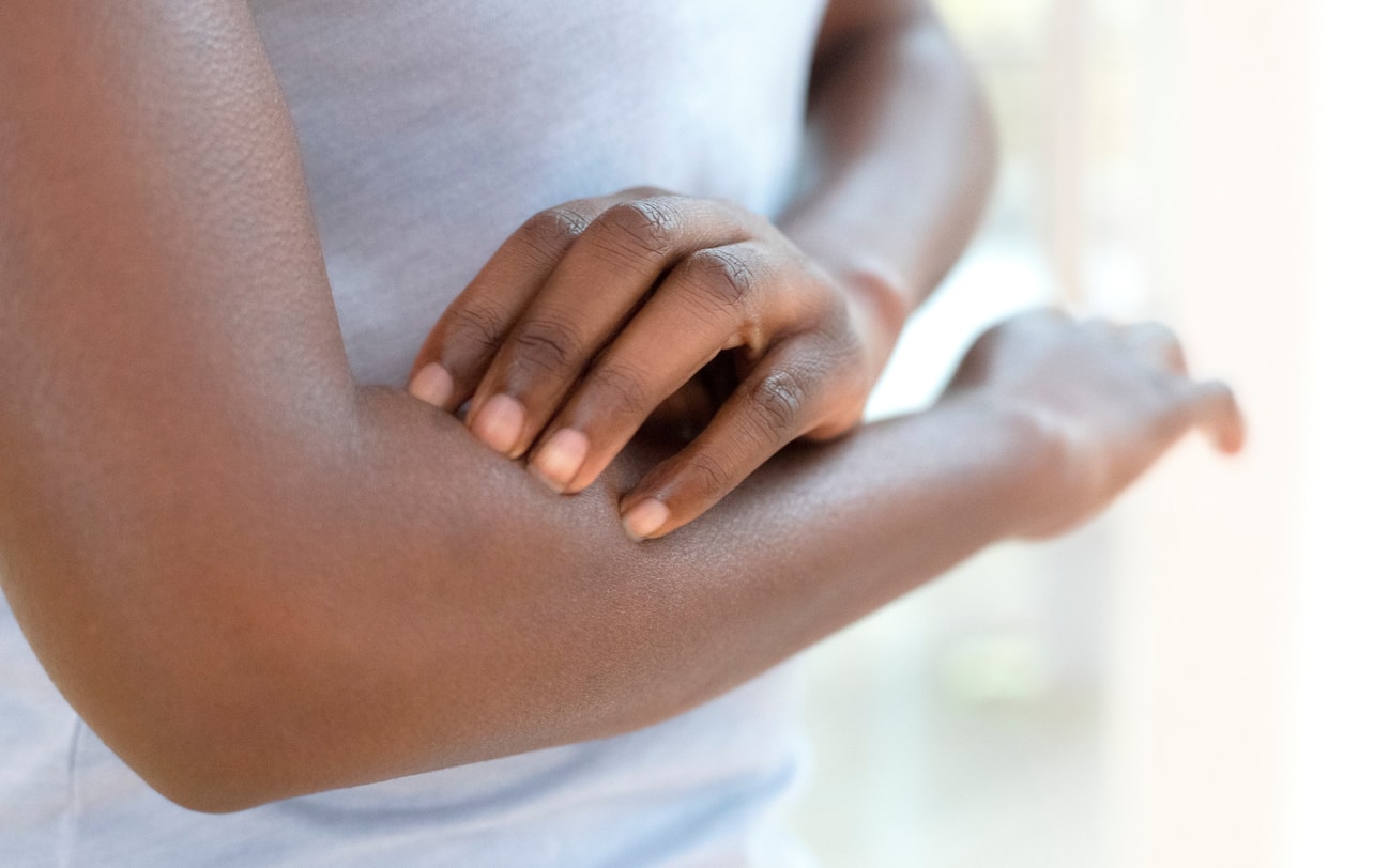 Covid, effetti anche sulla pelle: macchie, dermatiti ed eruzioni ...