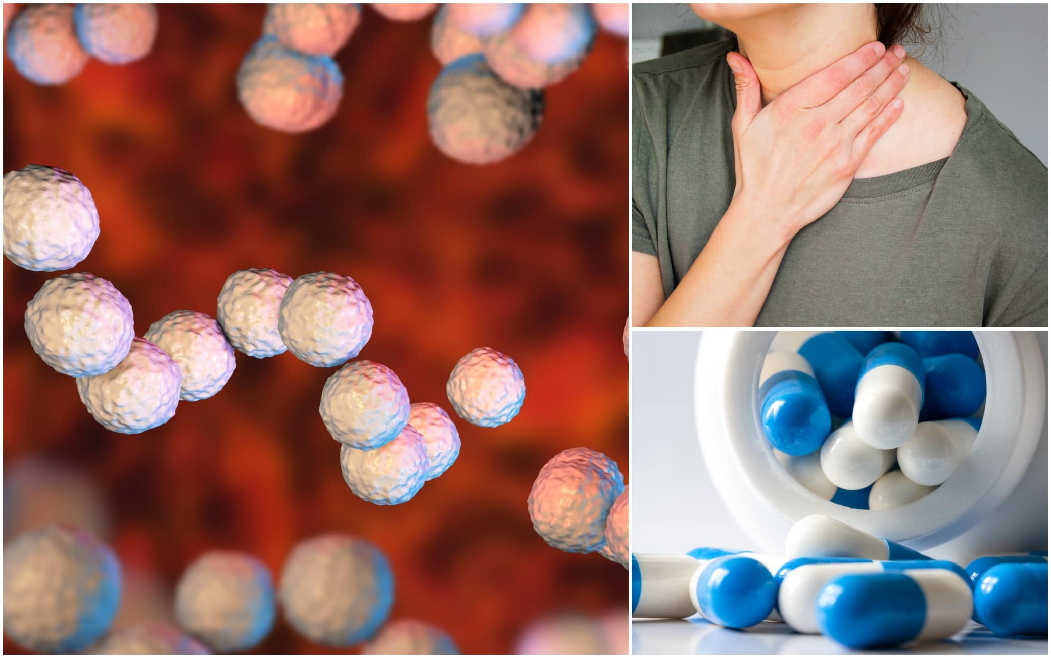 Streptococco, cresce la richiesta di tamponi. Quali sono i sintomi e ...