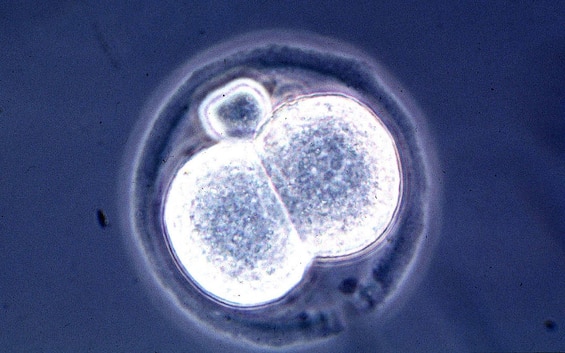 Ottenuti embrioni umani sintetici con cellule staminali per studiare ...