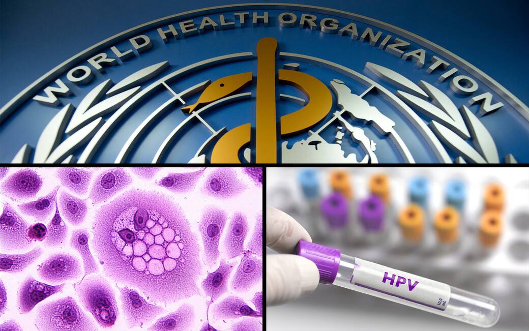 Papilloma virus, l'Oms: Alto rischio per un maschio over 15 su 5 | Sky TG24