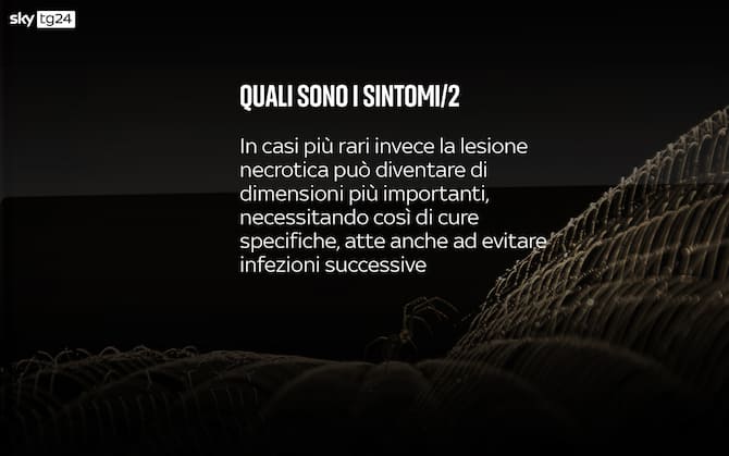 Ragno violino in Italia, come riconoscerlo, il morso e i sintomi. FOTO ...