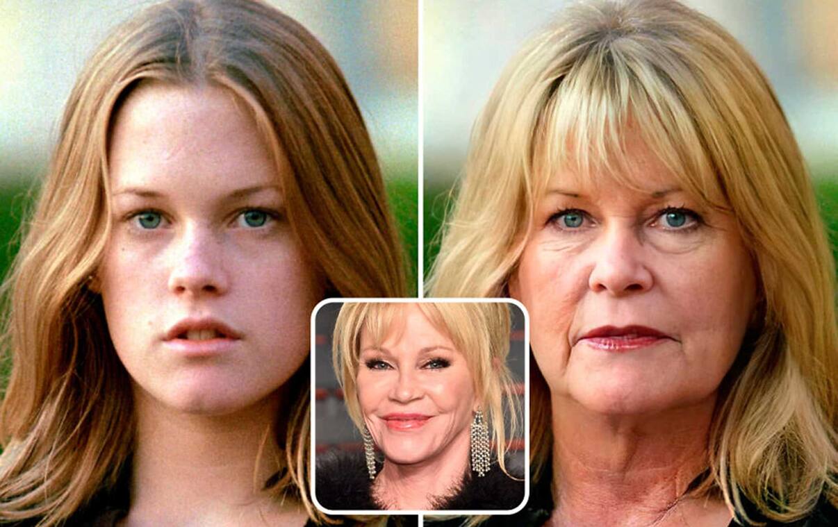 Da Madonna a Mickey Rourke, come sarebbero le star senza 'ritocchino'. FOTO