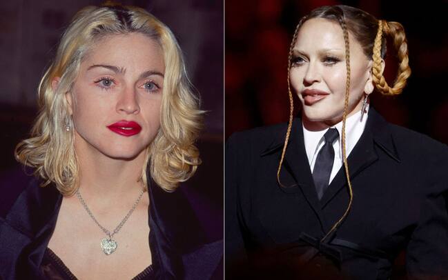 Da Madonna a Cher, 20 star che hanno ammesso di essersi ritoccate. FOTO