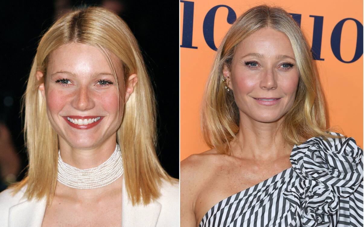 Da Madonna a Cher, 20 star che hanno ammesso di essersi ritoccate. FOTO