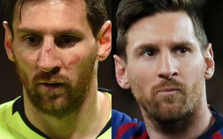 Messi, brutto colpo da Smalling al 30' di Manchester United-Barcellona ...